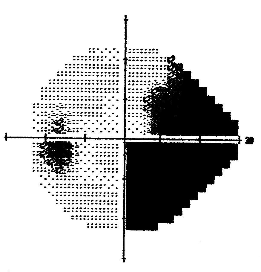 Home - Lees & Henschell Optometrists